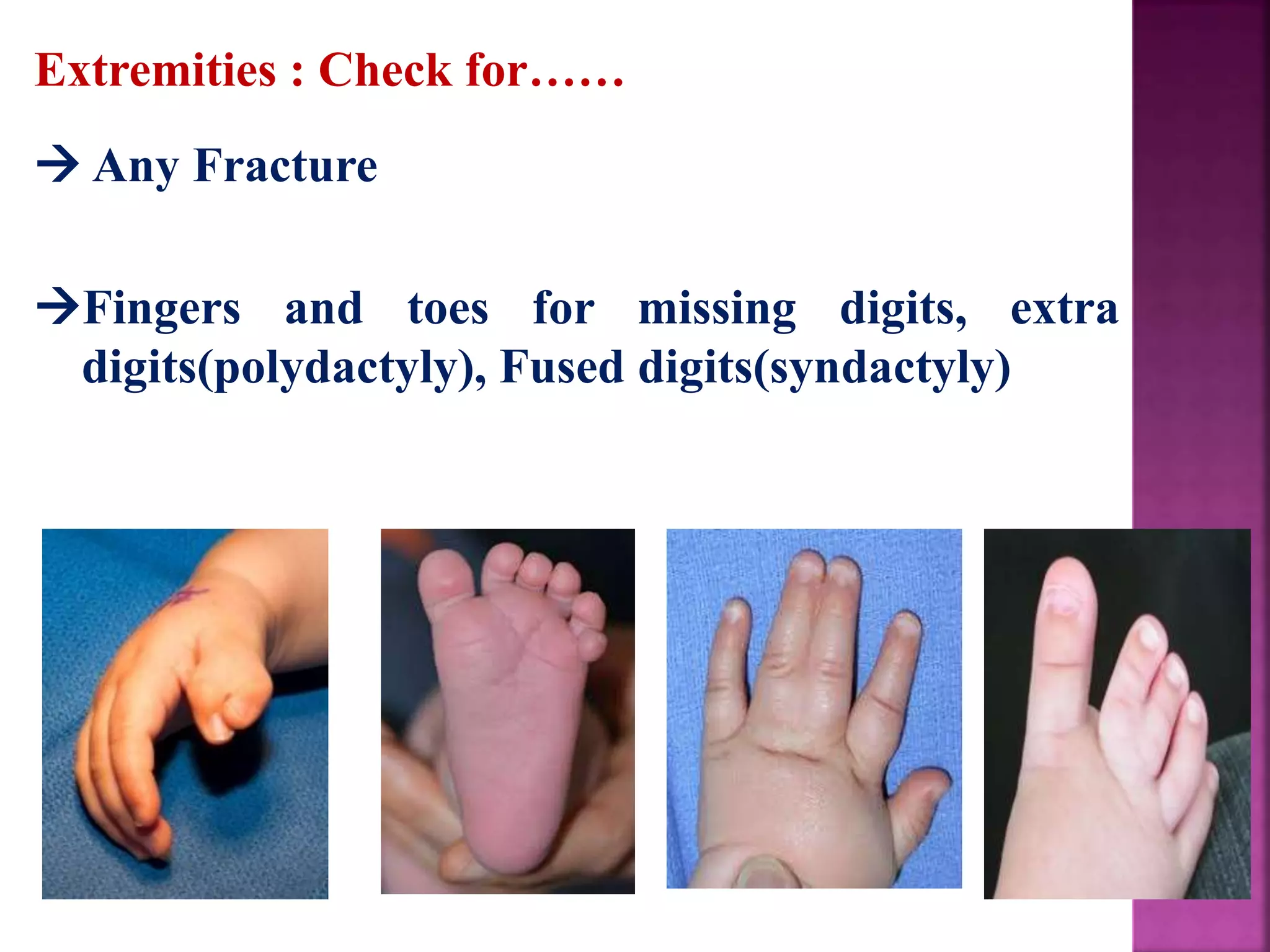 Newborn Assessment | PPT