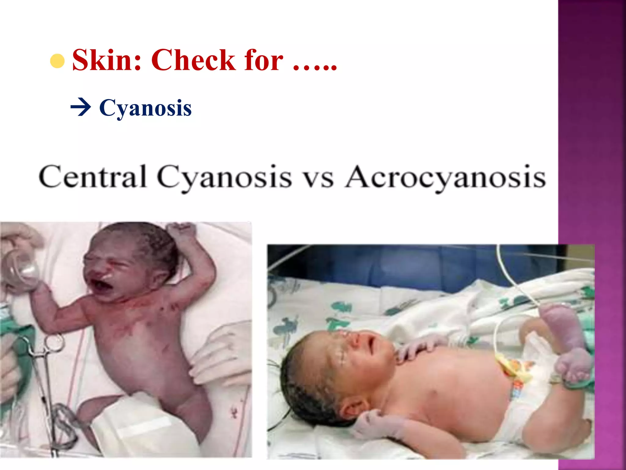 Newborn Assessment | PPT