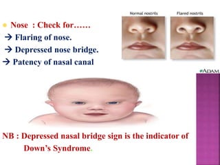 Newborn Assessment | PPT