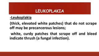 Health assessment on the mouth and oropharynx examination | PPTX