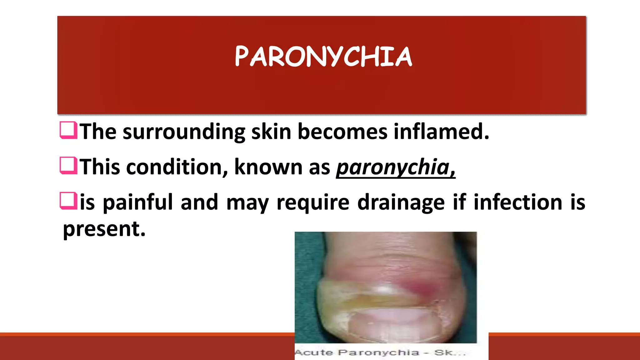 Health assessment on the nail examination | PPTX