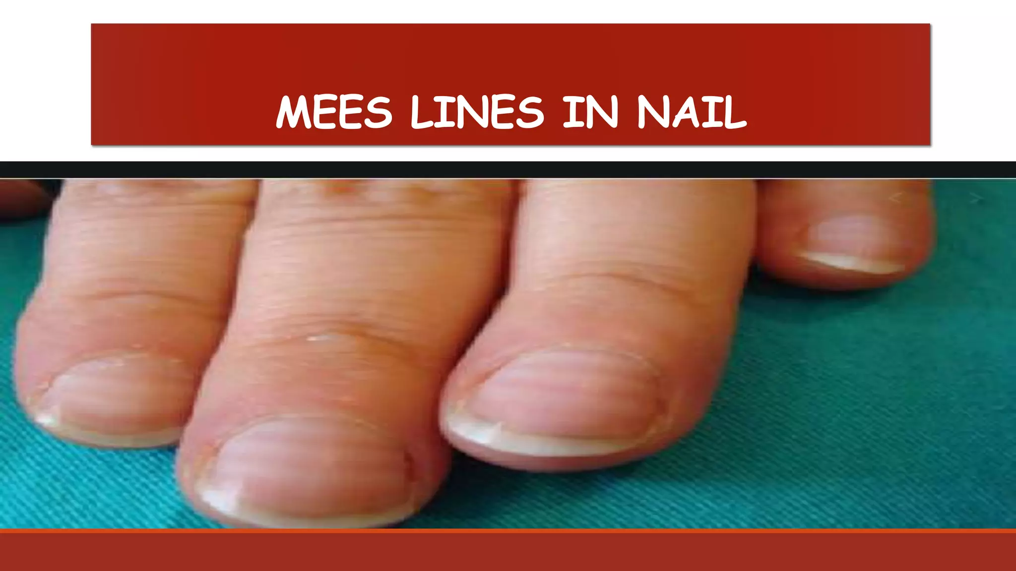 Health assessment on the nail examination | PPTX