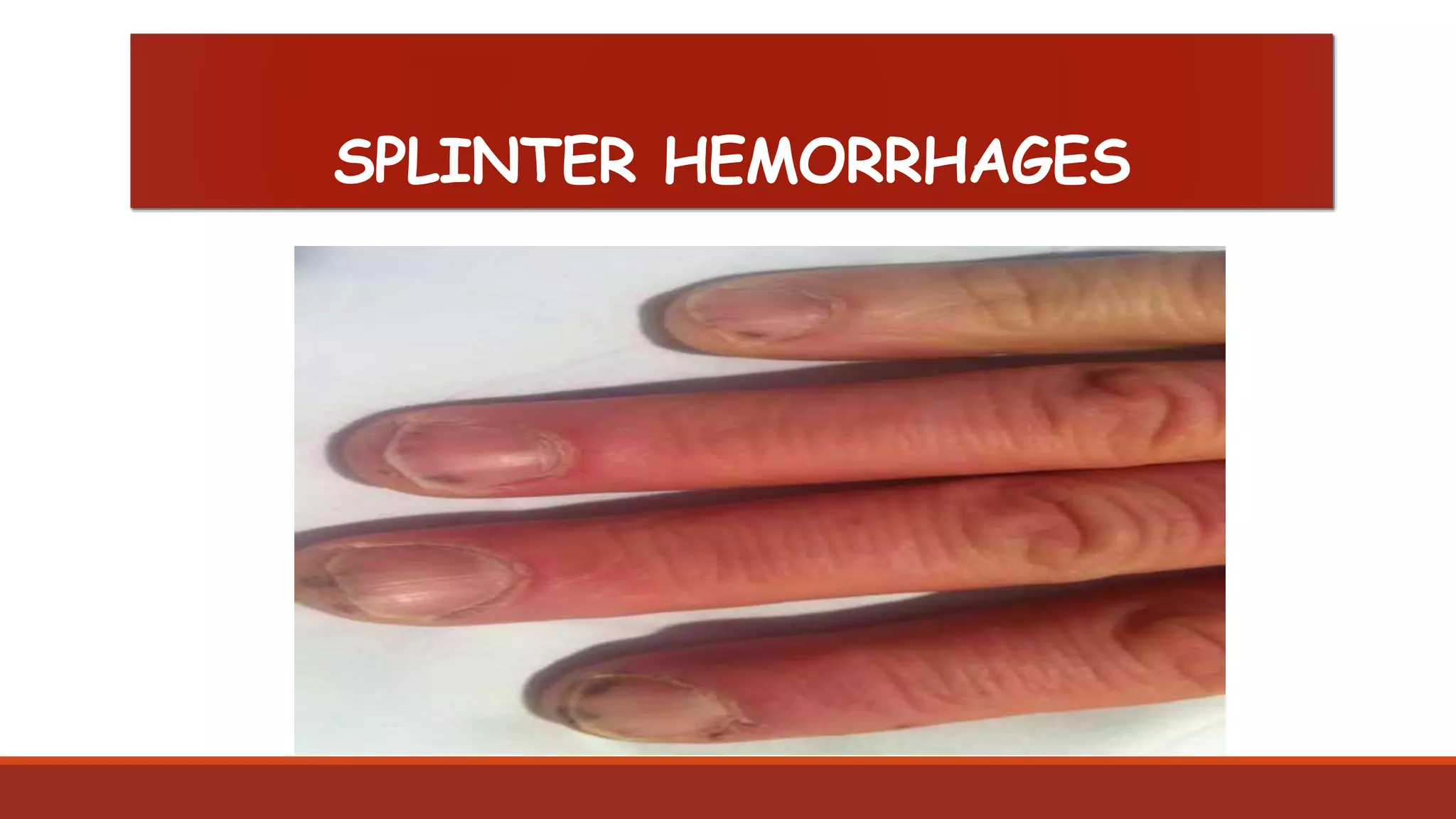 Health assessment on the nail examination | PPTX