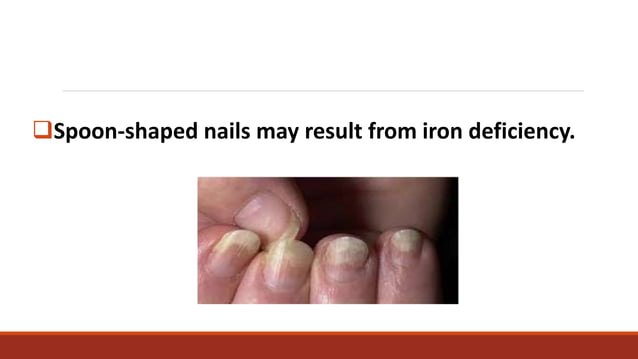 Health assessment on the nail examination | PPTX | Nail Care | Beauty