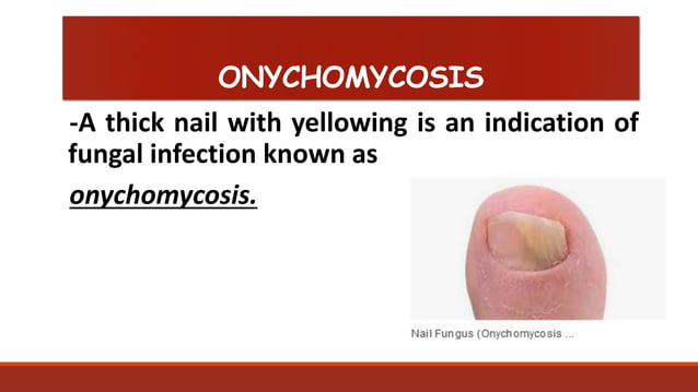 Health assessment on the nail examination | PPTX | Nail Care | Beauty