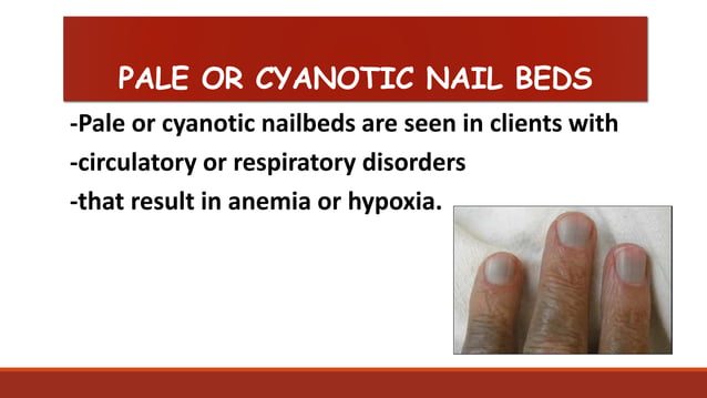 Health assessment on the nail examination | PPTX | Nail Care | Beauty