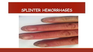 Health assessment on the nail examination | PPTX