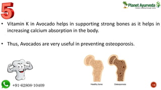 Health Benefits Of Avocados You Need to Know | PPTX