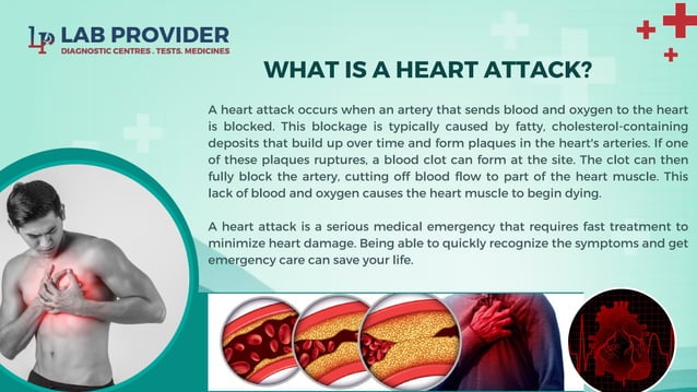 What is Heart Attack and its symptoms ? | PPT