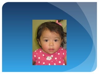 Pediatric Plastic Surgery | PPT