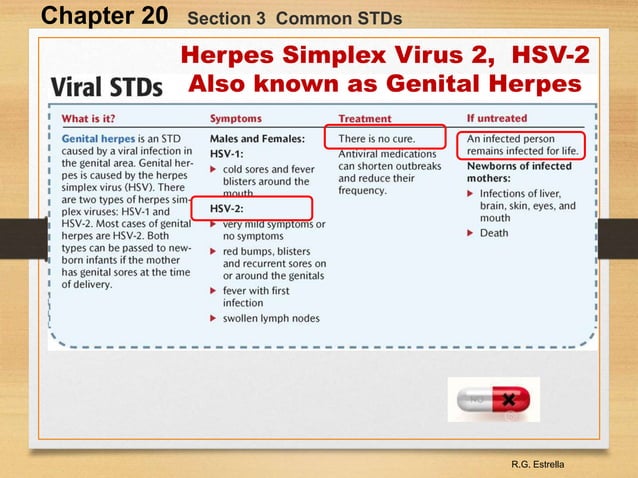STDs / HIV | PPT