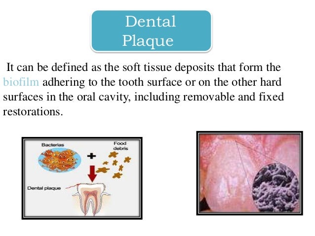 Health Education in Plaque Control.pptx 1.pptx