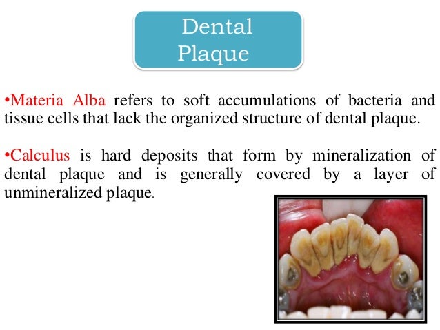Health Education in Plaque Control.pptx 1.pptx