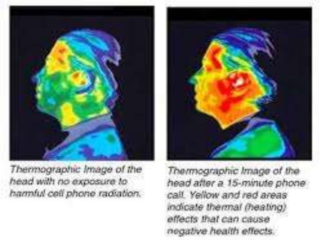 Health effects of mobile phones | PPTX | Brain and Nervous System ...