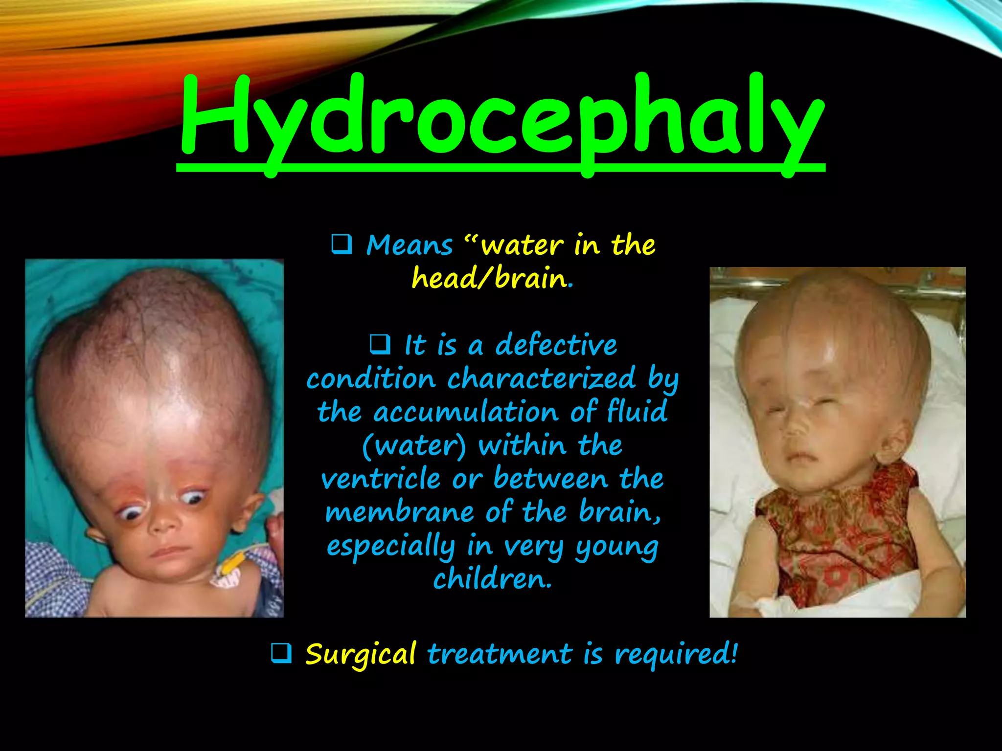 The Moral issue of Birth Deformities | PPTX