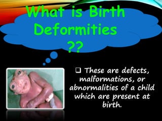 The Moral issue of Birth Deformities | PPTX