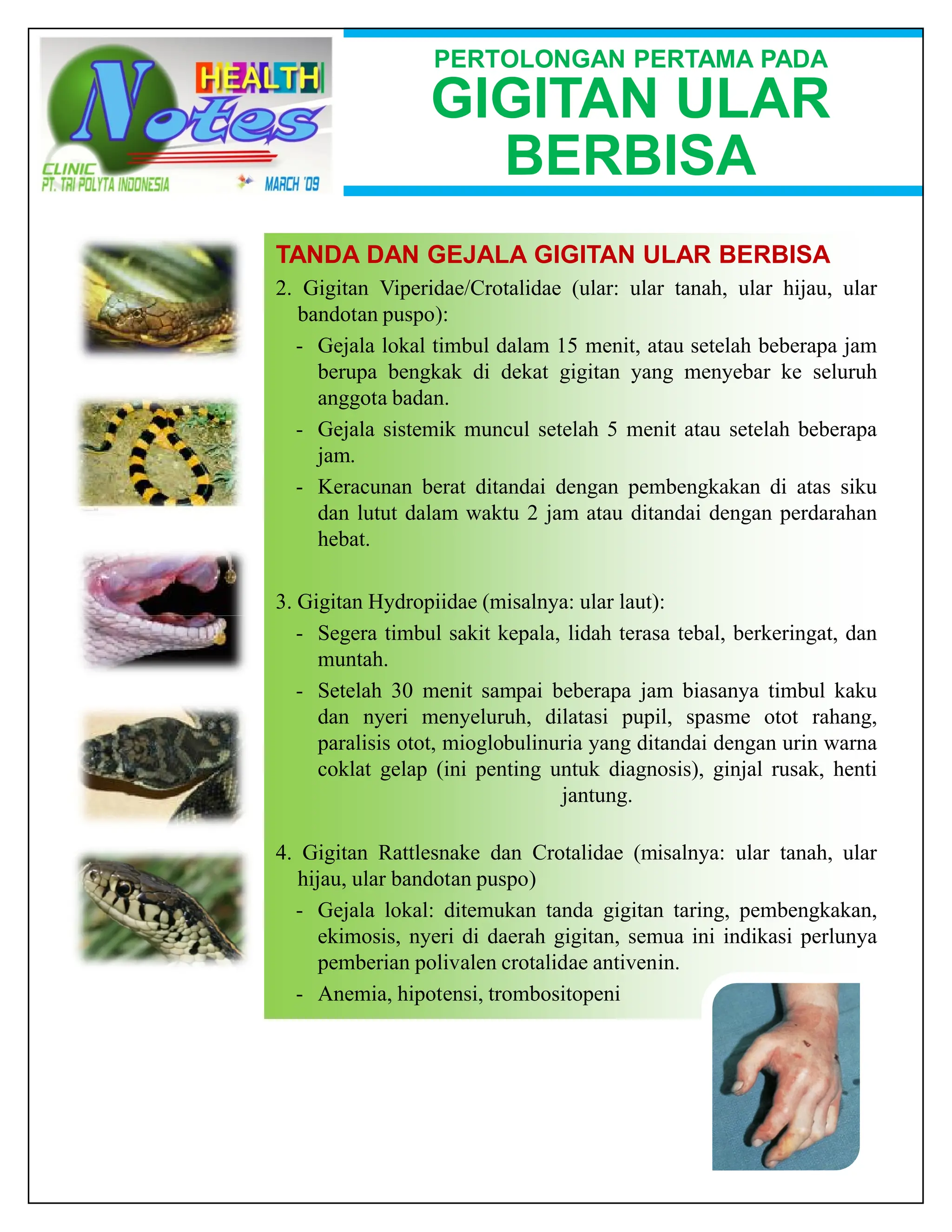 Health Notes Pertolongan Gigitan Ular Berbisa.pdf