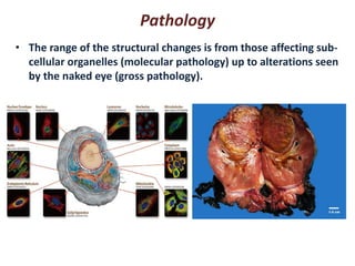 Introduction to pathology | PDF