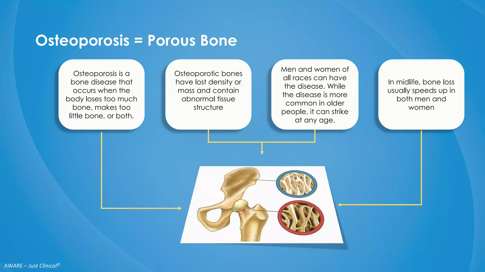 Healthstance Osteoporosis Awareness Month | PDF