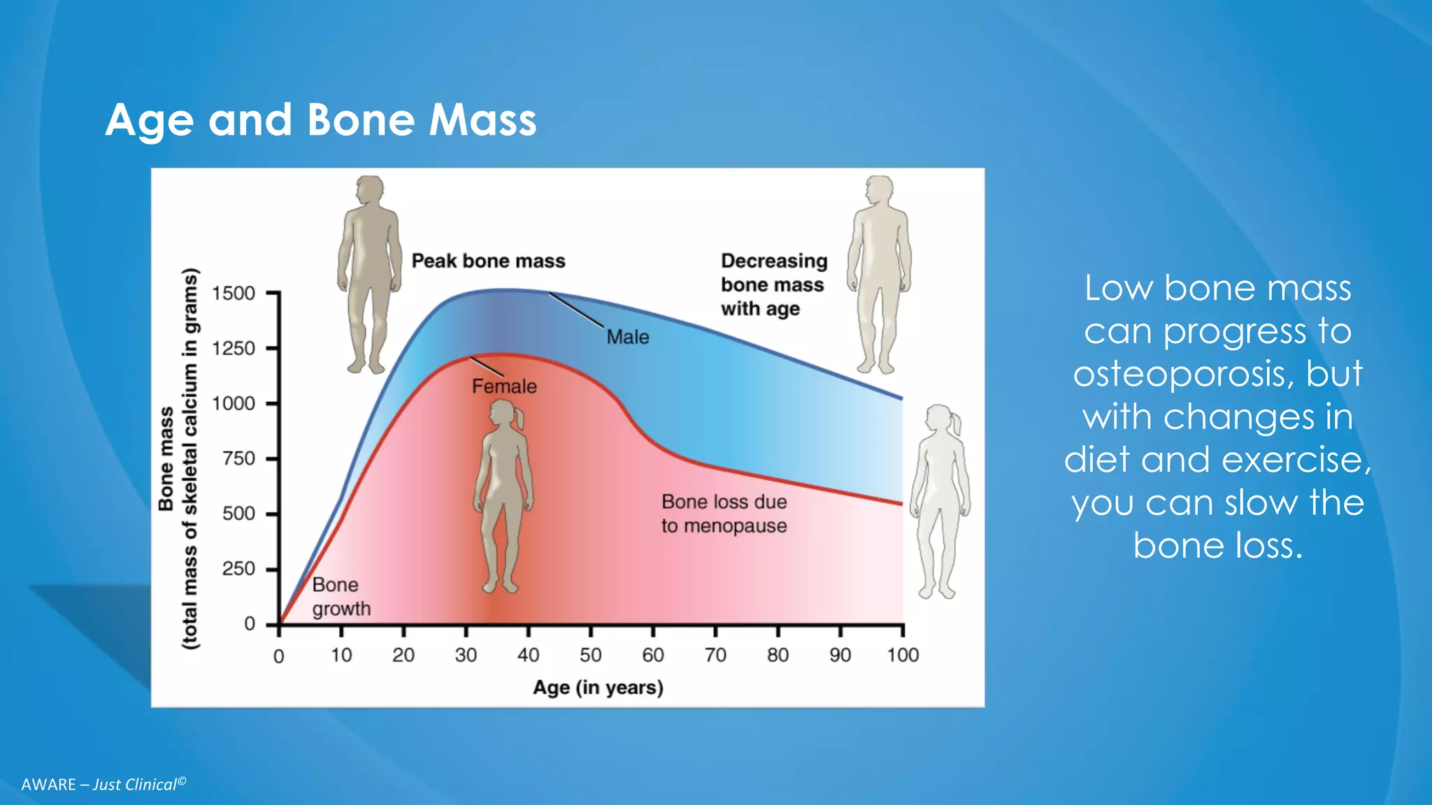 Healthstance Osteoporosis Awareness Month | PDF
