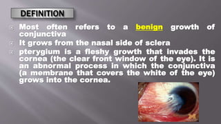 Health Talk 24 December 2022 - Pterygium.ppt