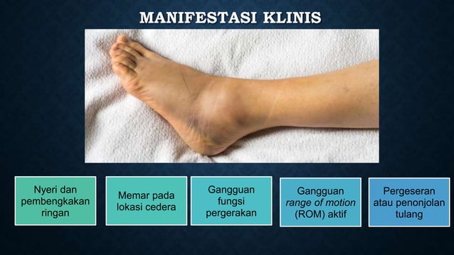 HEALTH TALK ANKLE SPRAIN AND ANKLE STRAIN | PPTX