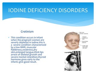 Health talk on iodine deficiency | PPTX