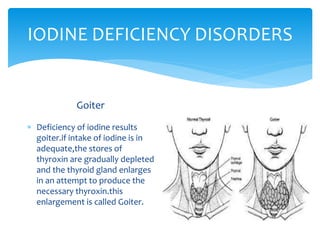 Health talk on iodine deficiency | PPTX