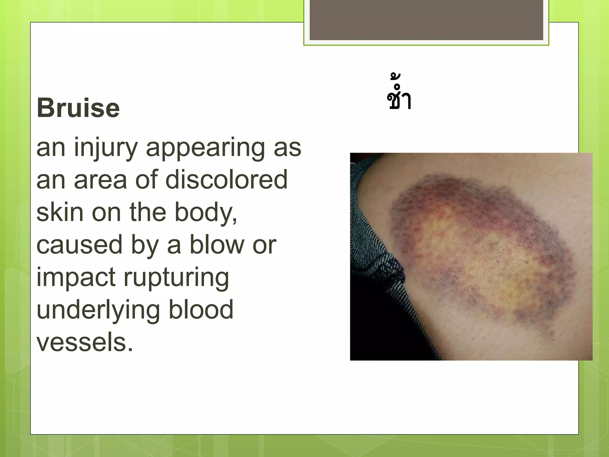 Health Problems | PPTX