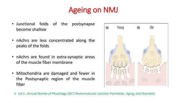 Healthy and unhealthy nmj | PPT