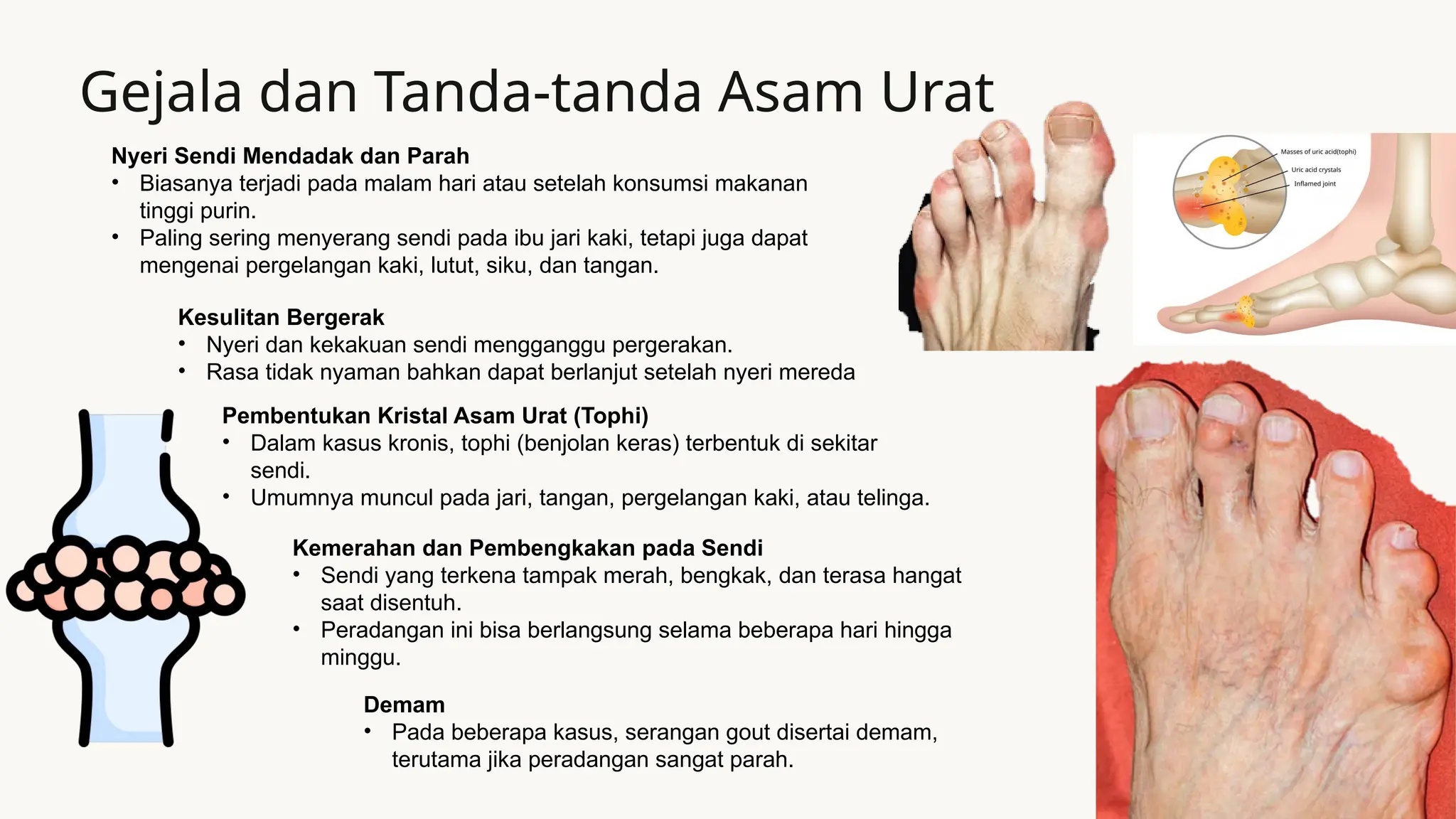 materi presentasi penyakit Asam Urat.pptx