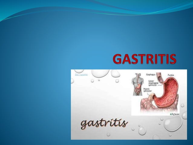 healty talk GASTRITIS.pptx