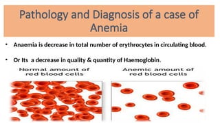 HEAMATOLOGICAL FINDINGS OF ANAEMIA STUDY.pptx