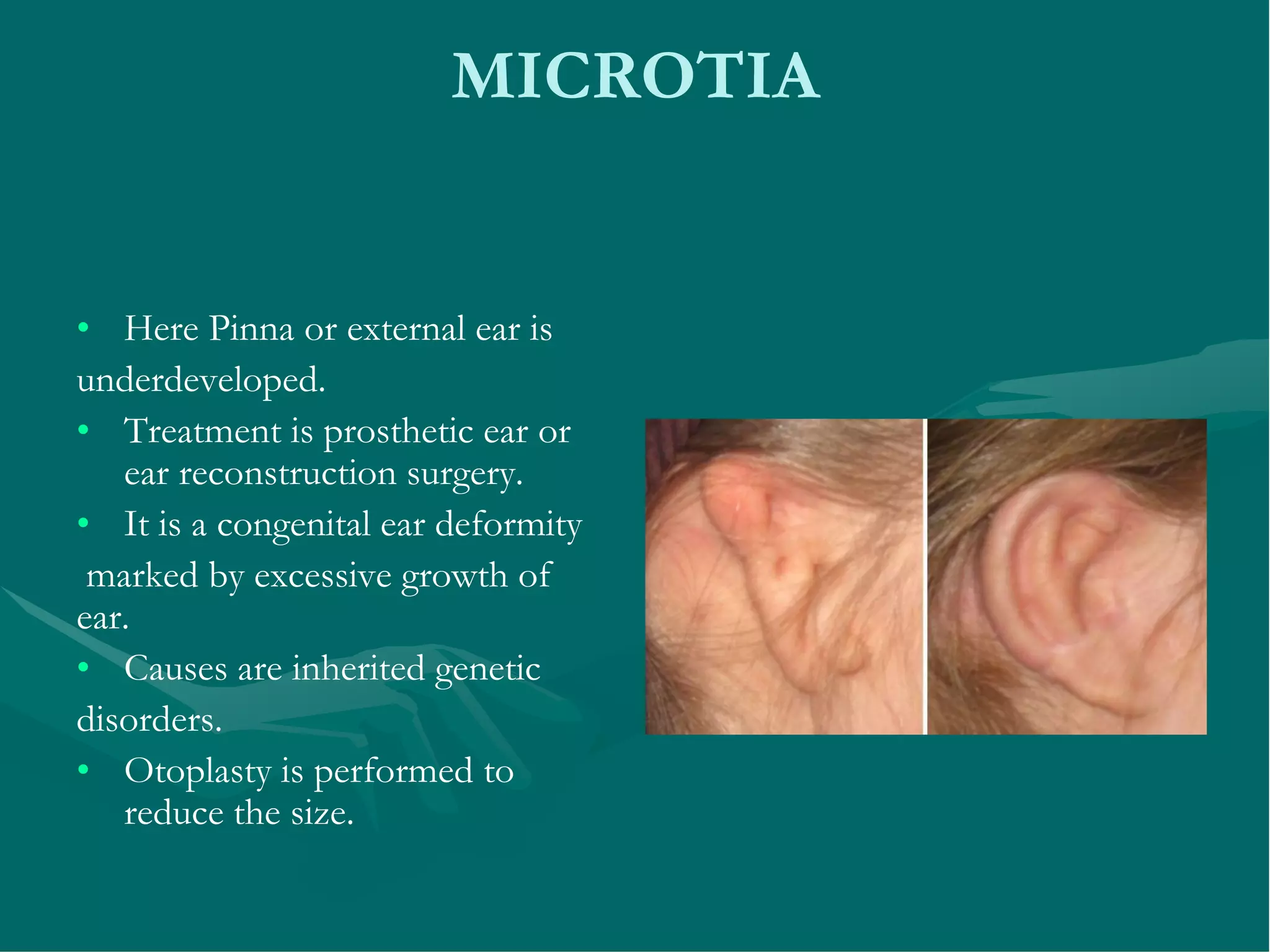 Hearing abnormalities | PDF