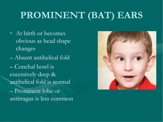 Hearing abnormalities | PPT