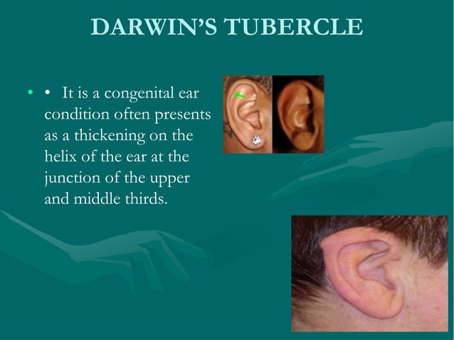 Hearing abnormalities | PPT