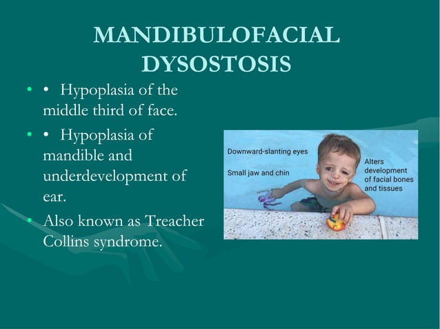 Hearing abnormalities | PPT