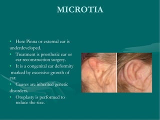 Hearing abnormalities | PPT