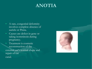 Hearing abnormalities | PPT