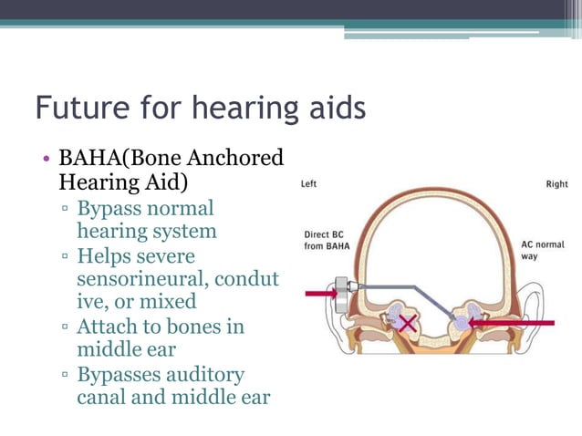 Hearing aids | PPT