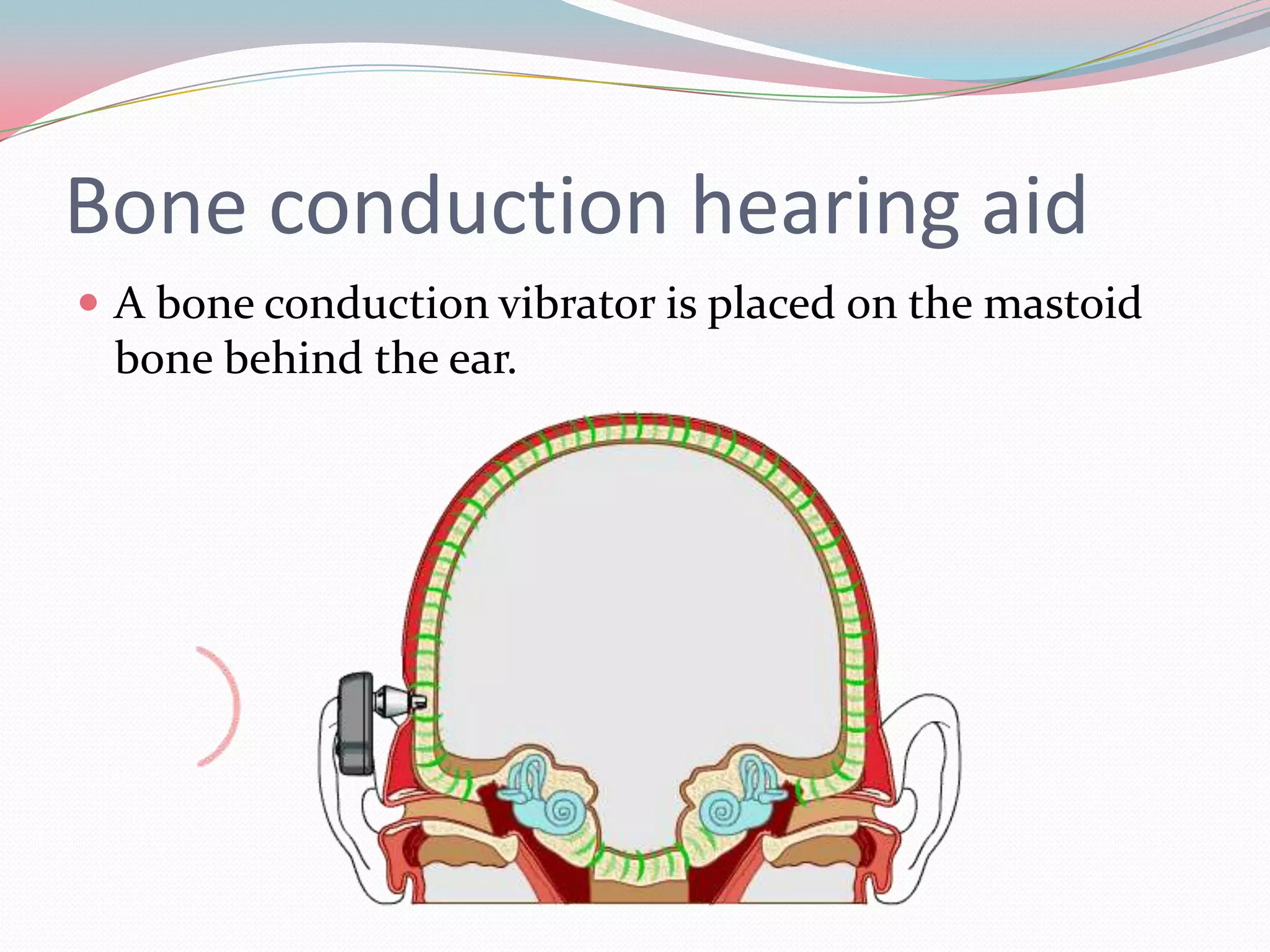 Hearing aids | PPTX