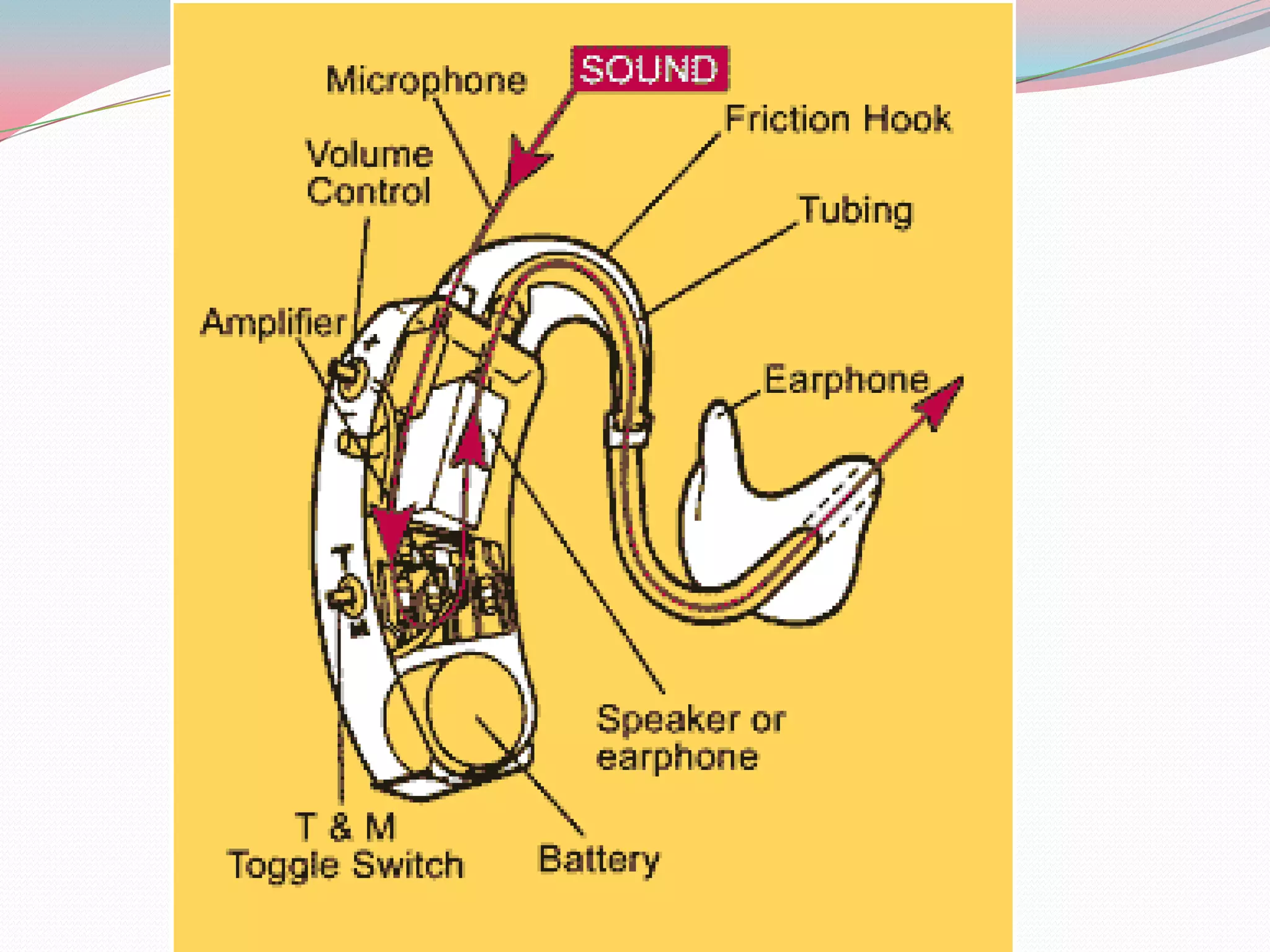 Hearing aids | PPTX