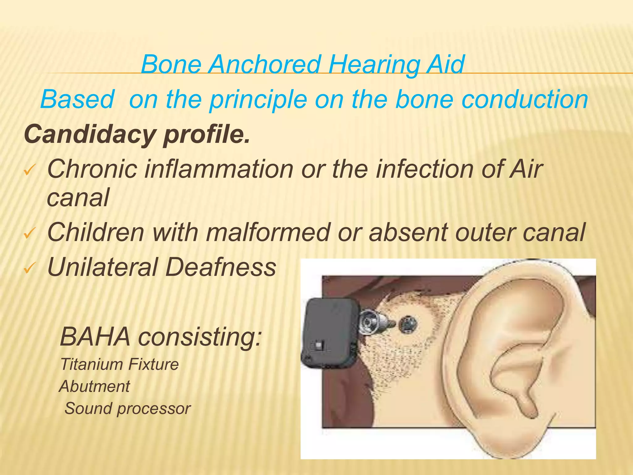 Hearing Aids | PPTX