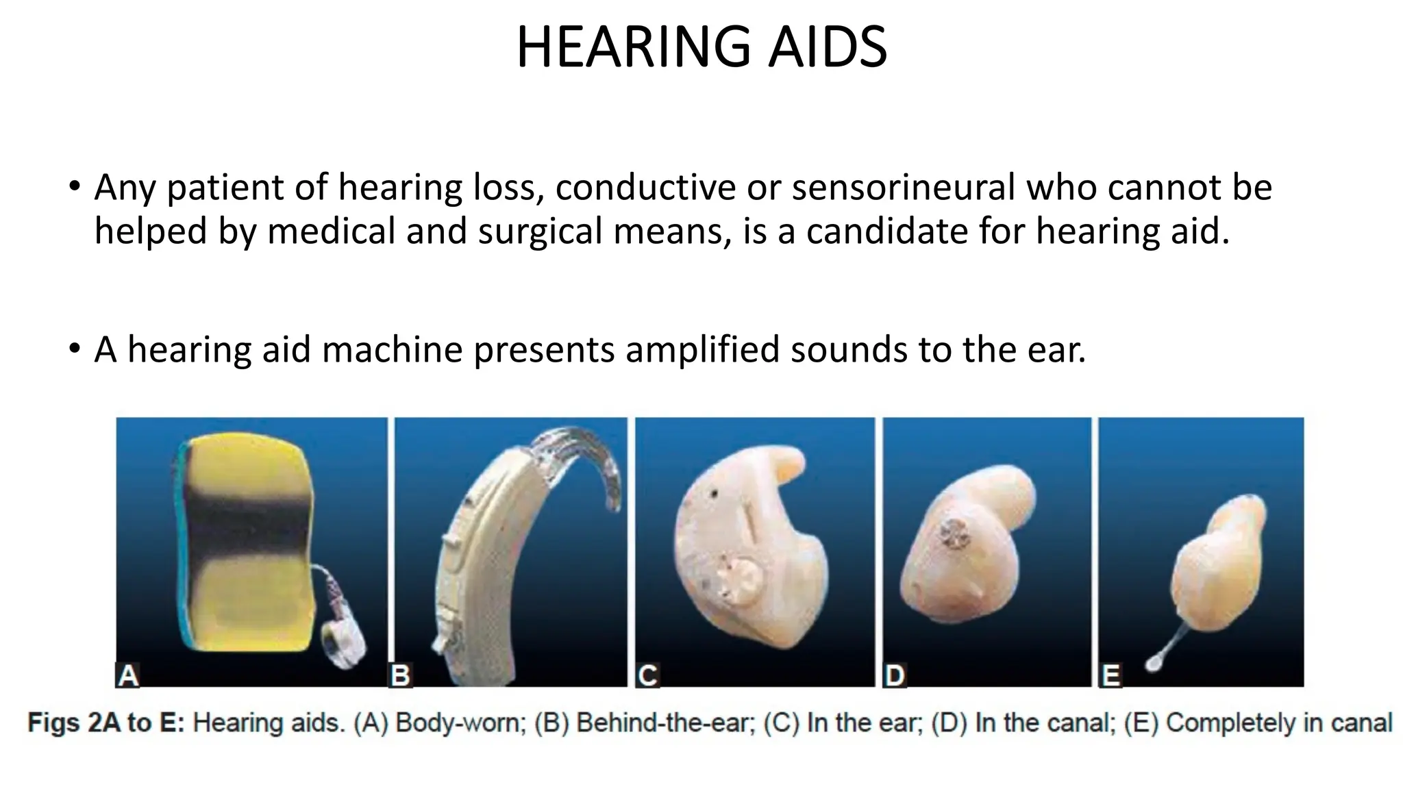 hearing aids, cochlear implants, middle ear implants, bone anchored ...