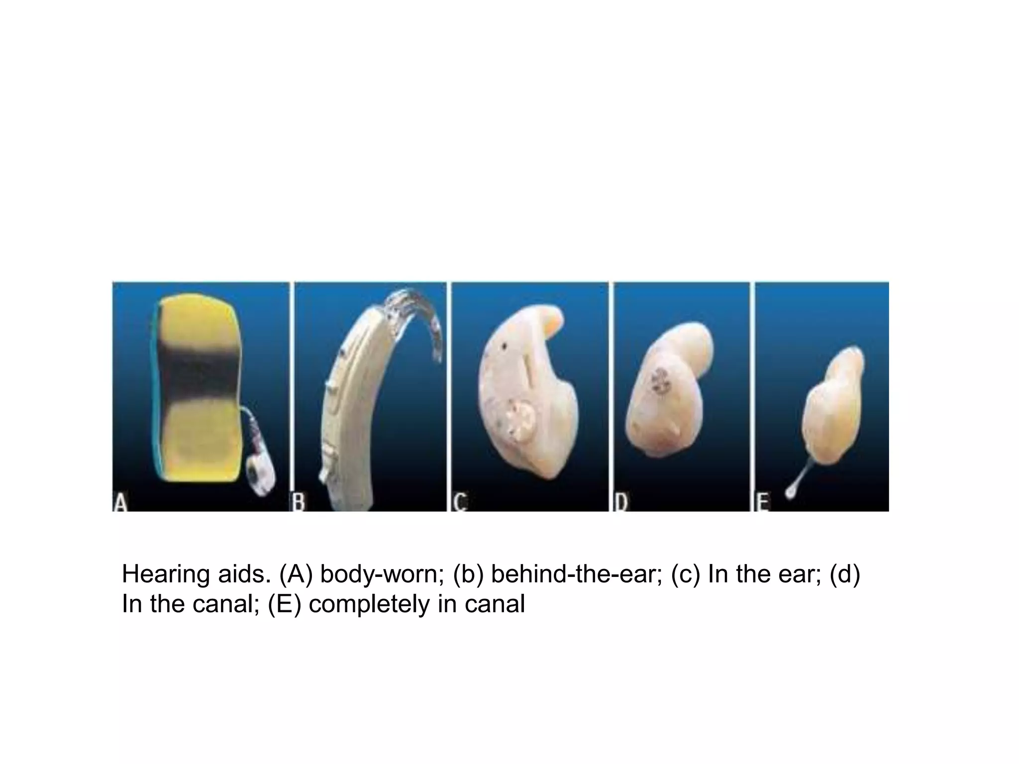 Hearing aids and cochlear implants.pptx