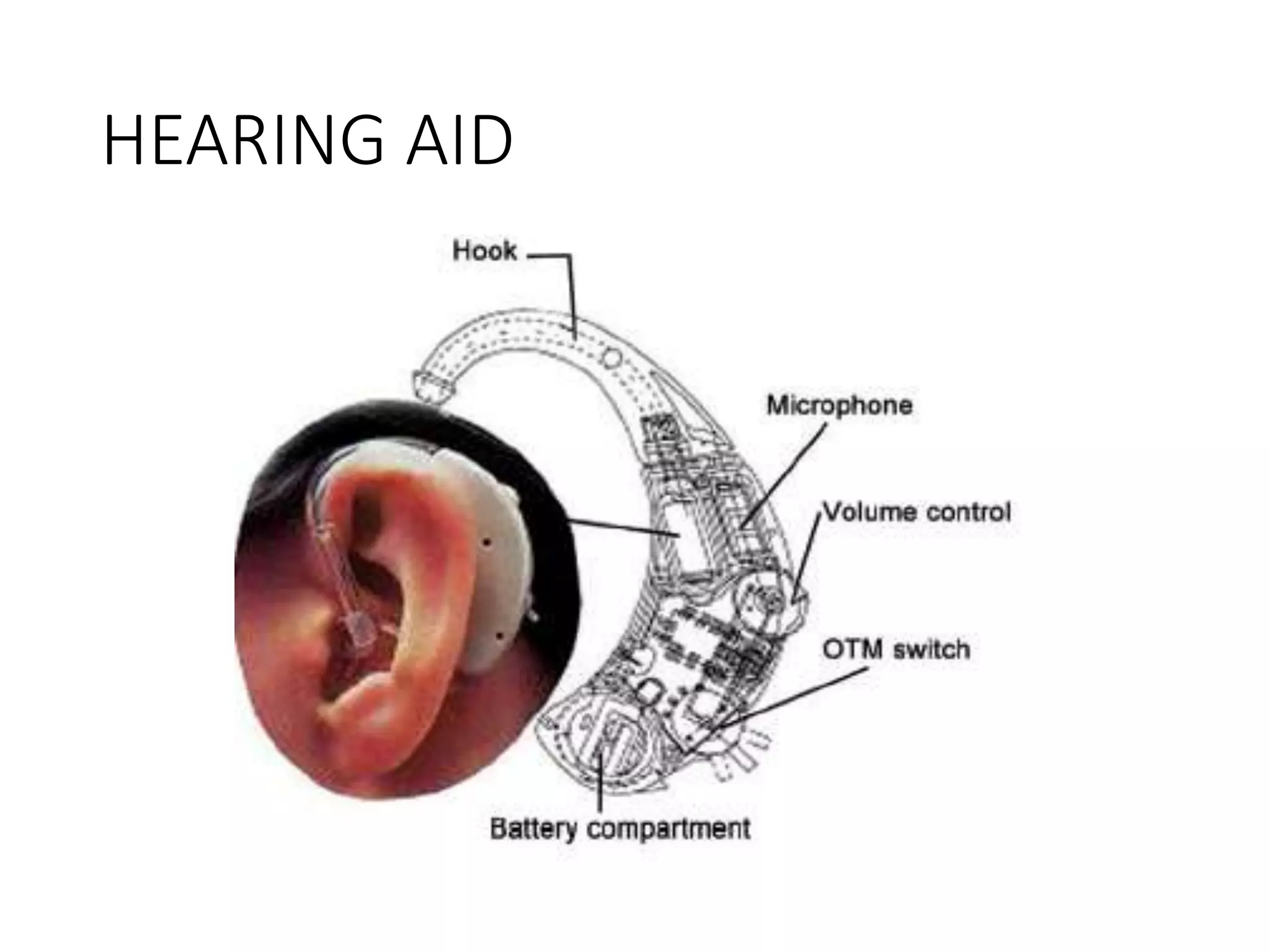Hearing aids and cochlear implants.pptx