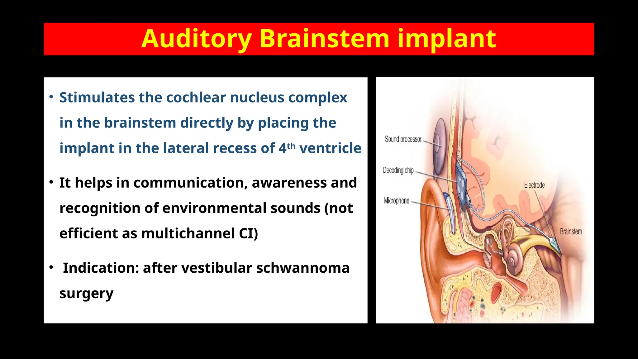 Hearing aids and cochlear implant Dr.Krishna Koirala .pptx
