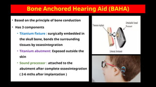 Hearing aids and cochlear implant Dr.Krishna Koirala .pptx