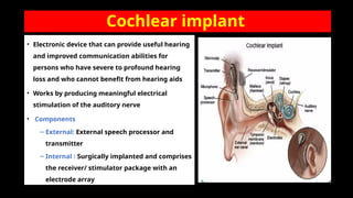 Hearing aids and cochlear implant Dr.Krishna Koirala .pptx