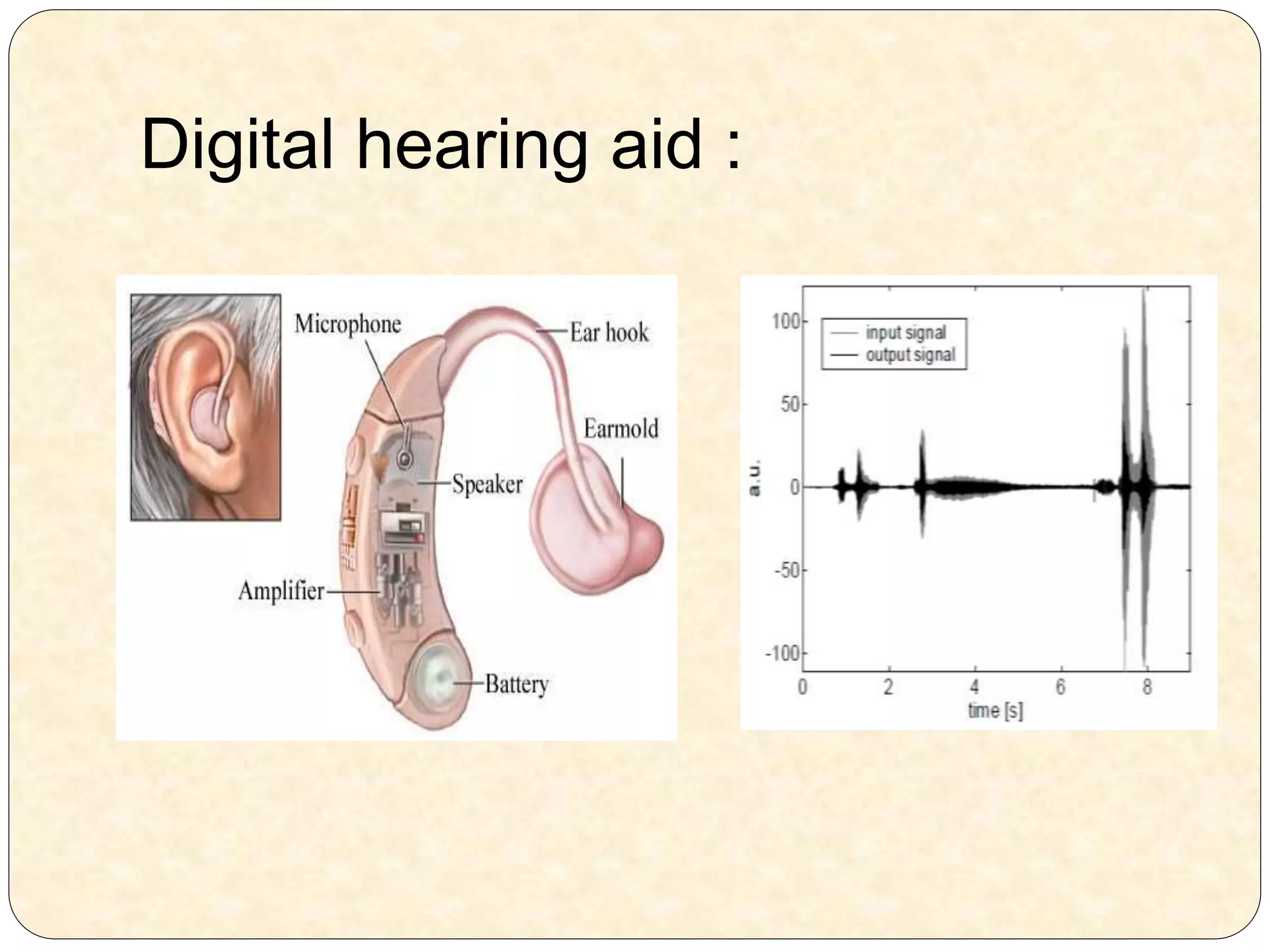 Digital Hearing aid | PPTX
